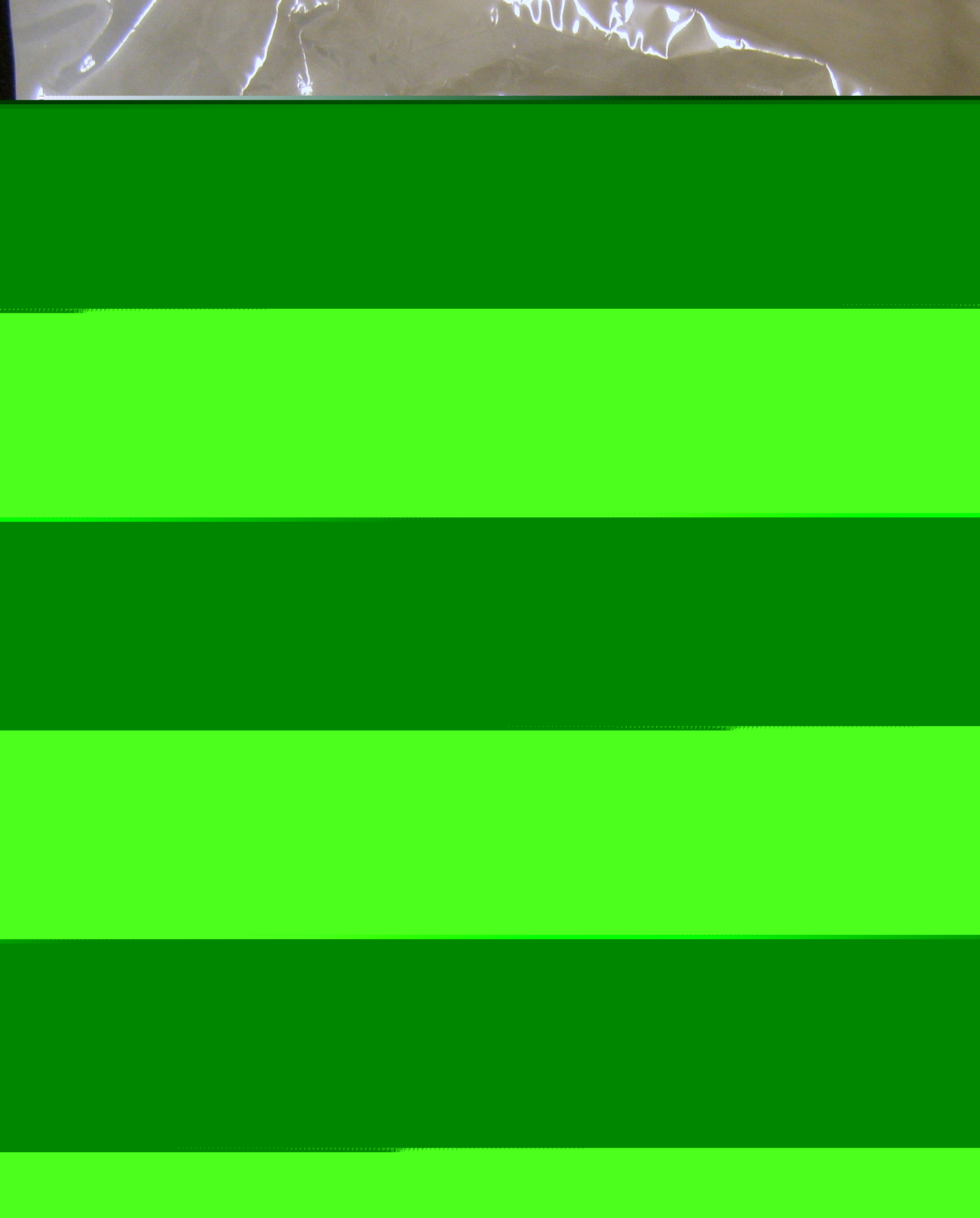 medsurplusonline -RIGIFLEX II Achalasia Balloon Dilator